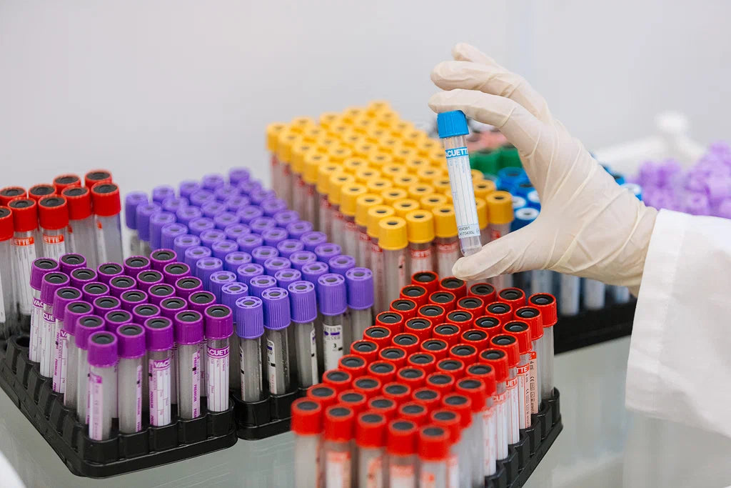 Analyseurs, Matériels et Consommable de Laboratoire au Maroc – NEXUS ...